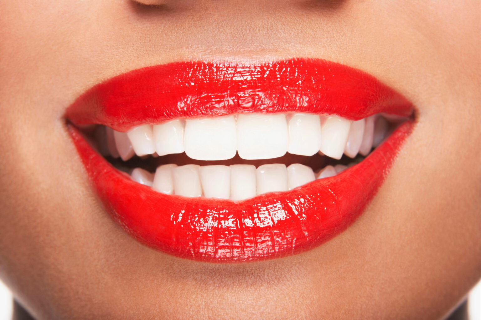 Veneers Offer A Chance For Smile Makeovers | Kansas City, MO